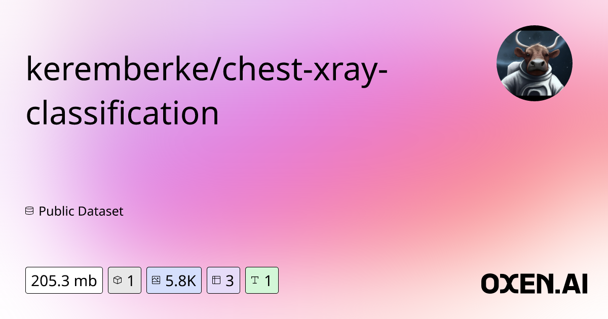 keremberke/chest-xray-classification | Datasets at Oxen.ai keremberke/chest-xray-classification | Datasets at Oxen.ai